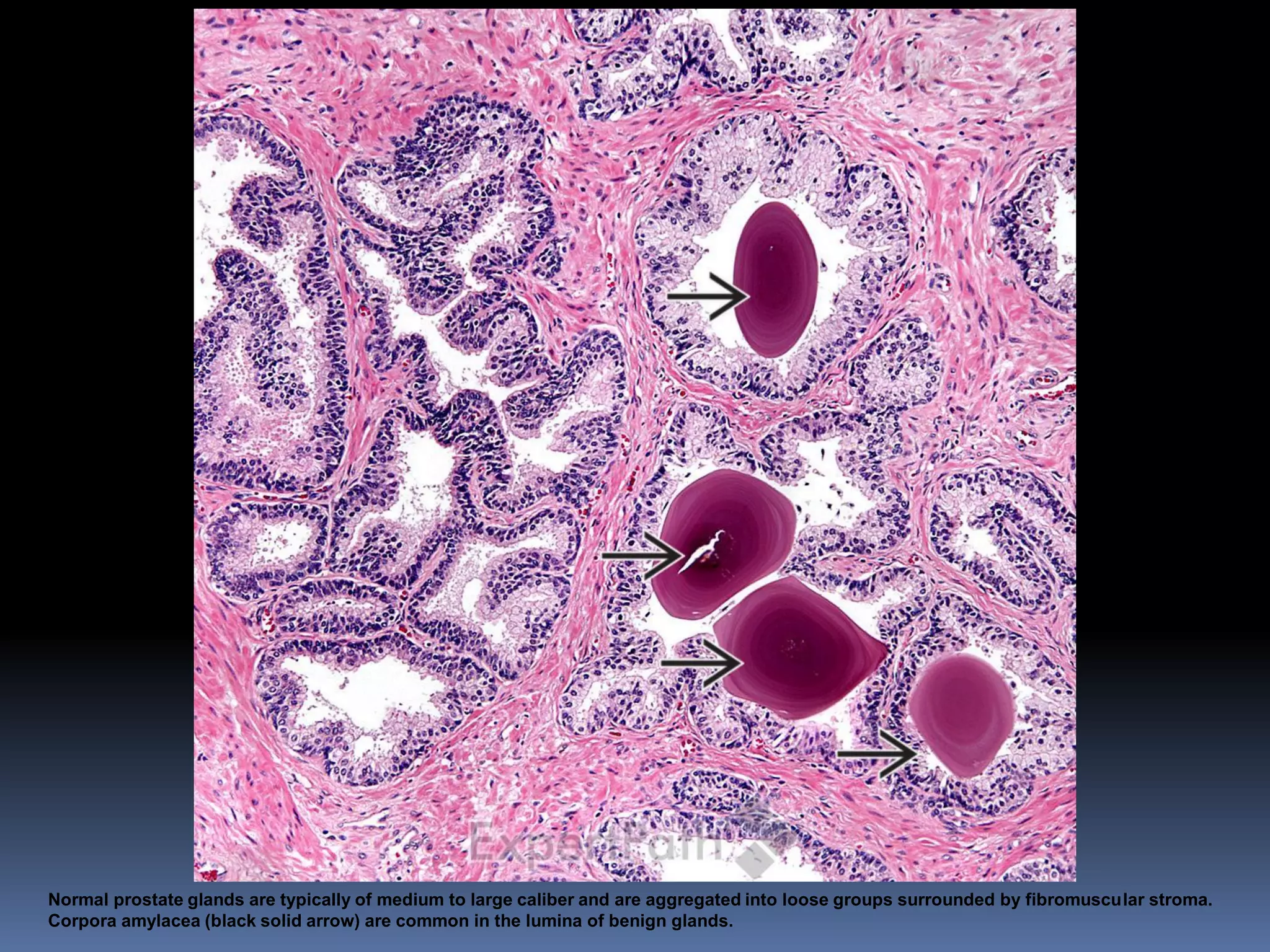 Tema 8-APARATO REPRODUCTOR MASCULINO.pdf