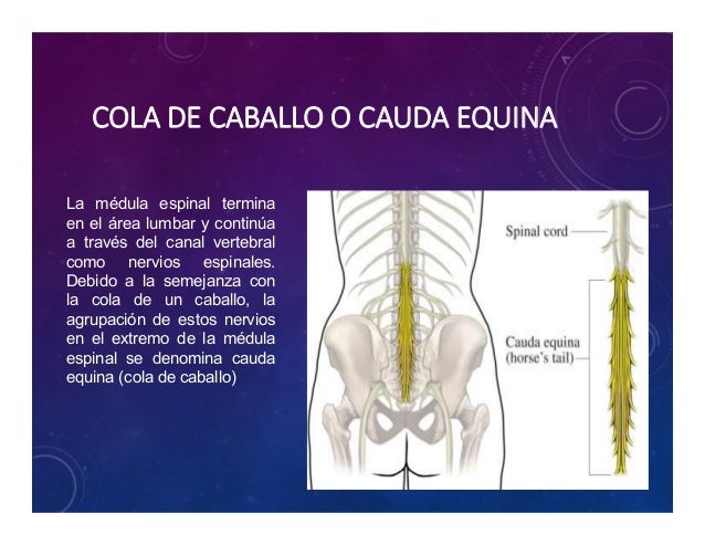 Tema 8 columa lumbar