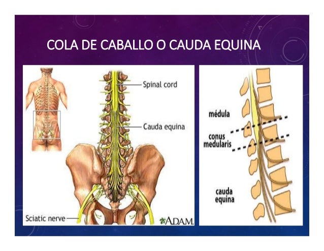 Tema 8 columa lumbar