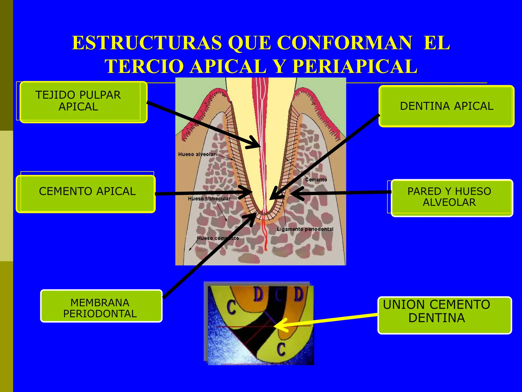 TEMAS PATOLOGÍAS APICAL Y PERIAPICAL EN ODONTOLOGIA | PPT