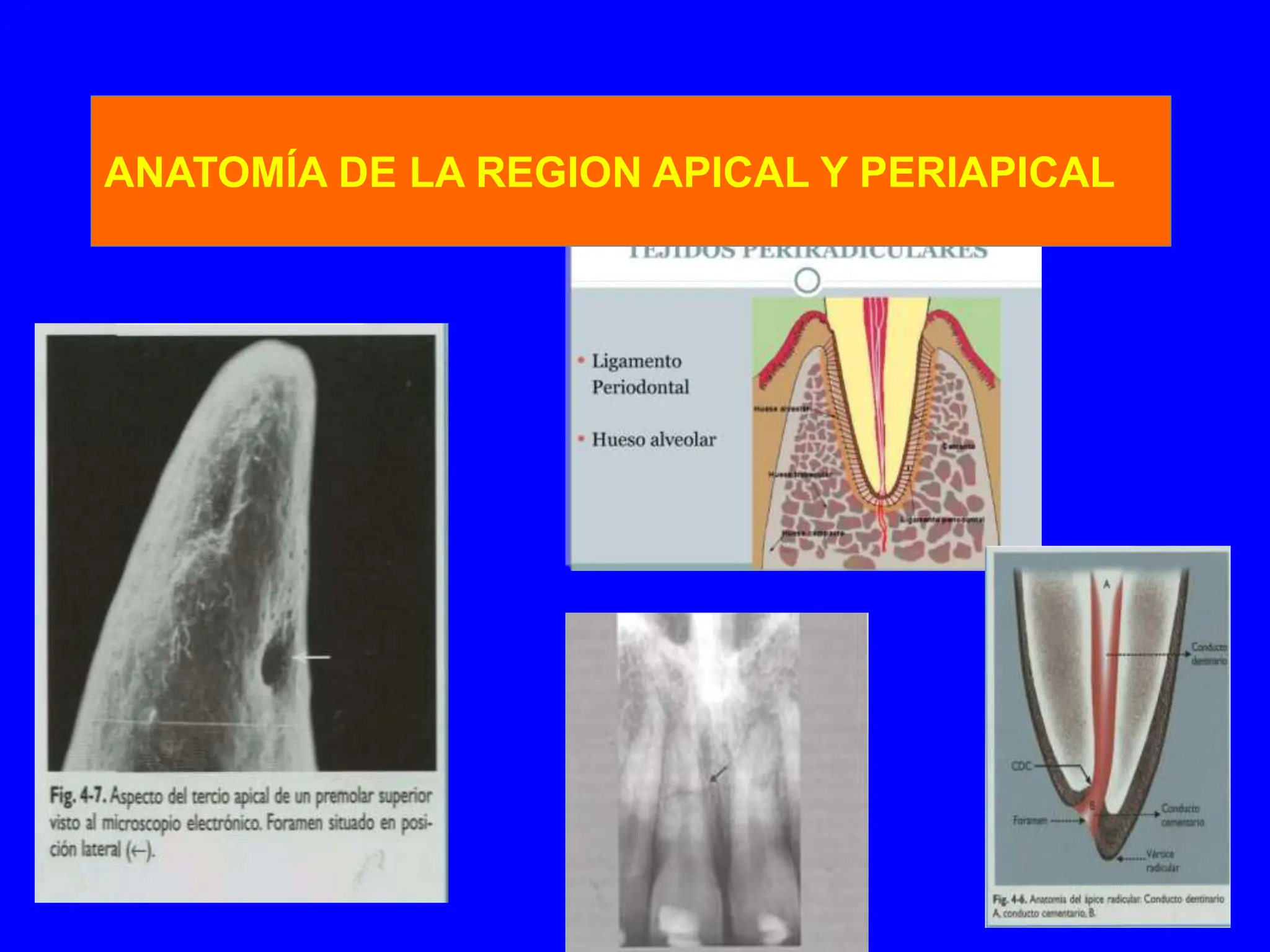 TEMAS PATOLOGÍAS APICAL Y PERIAPICAL EN ODONTOLOGIA | PPT