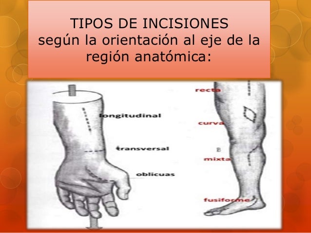 posiciones e incisiones en cirugía