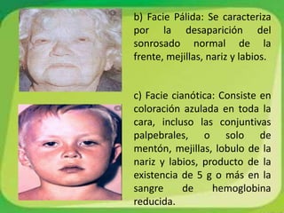 Tema facies | PPTX