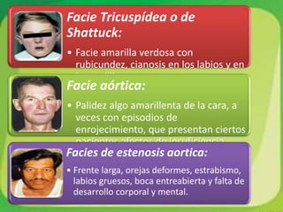 Tema facies | PPTX