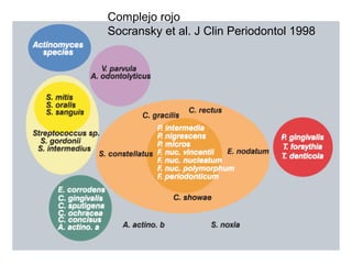 Tema m28 enfermedad_periodontal_periodontitis