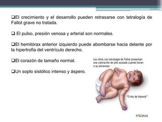 TEMA N° 4 cardiopatias congenitas CORAZON.pptx