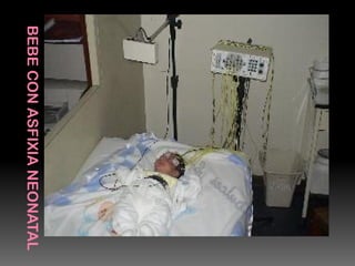 TEMA N°9-ASFIXIA NEONATAL CUIDADOS BASICOS.pptx