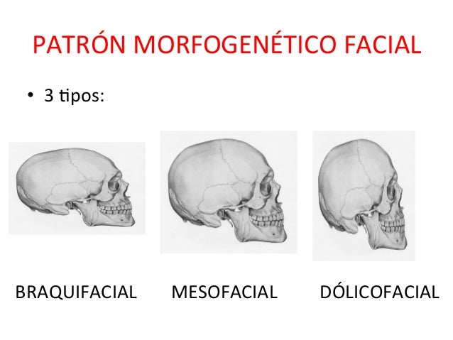 etiología de las maloclusiones