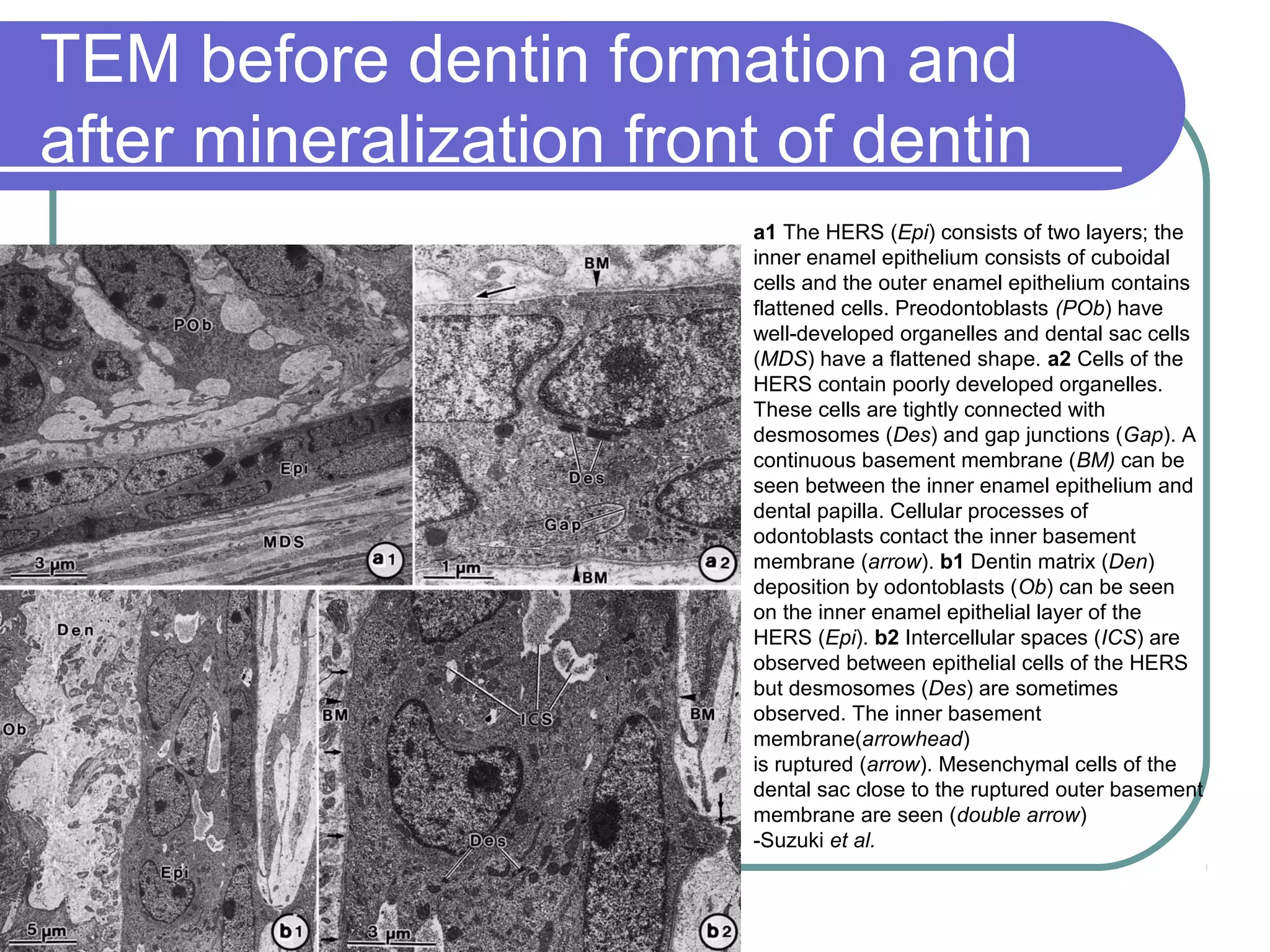 Tem images of bone, dentin, cementum and enamel | PPT
