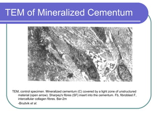 Tem images of bone, dentin, cementum and enamel | PPT