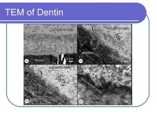 Tem images of bone, dentin, cementum and enamel | PPT