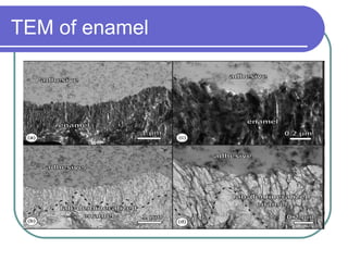 Tem images of bone, dentin, cementum and enamel | PPT