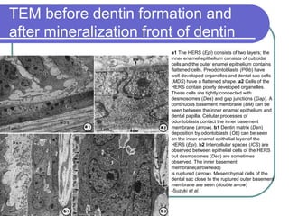 Tem images of bone, dentin, cementum and enamel | PPT