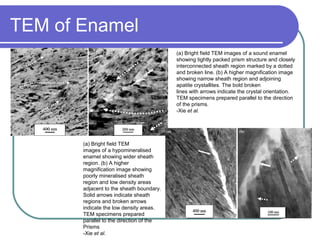 Tem images of bone, dentin, cementum and enamel | PPT