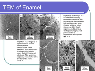 Tem images of bone, dentin, cementum and enamel | PPT
