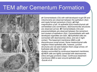 Tem images of bone, dentin, cementum and enamel | PPT