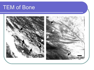 Tem images of bone, dentin, cementum and enamel | PPT