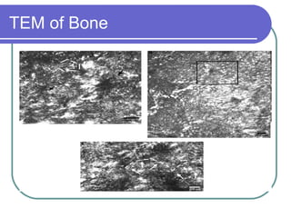 Tem images of bone, dentin, cementum and enamel | PPT