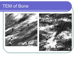 Tem images of bone, dentin, cementum and enamel | PPT