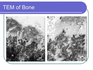 Tem images of bone, dentin, cementum and enamel | PPT