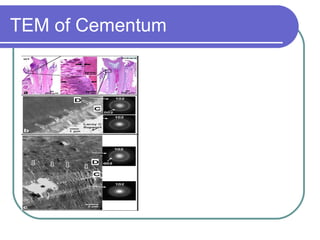 Tem images of bone, dentin, cementum and enamel | PPT