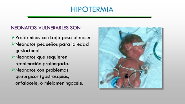Temperatura en el rn e hipotermia controlada