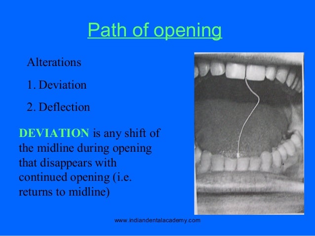 Temperomandibular joint /certified fixed orthodontic courses by Ind…