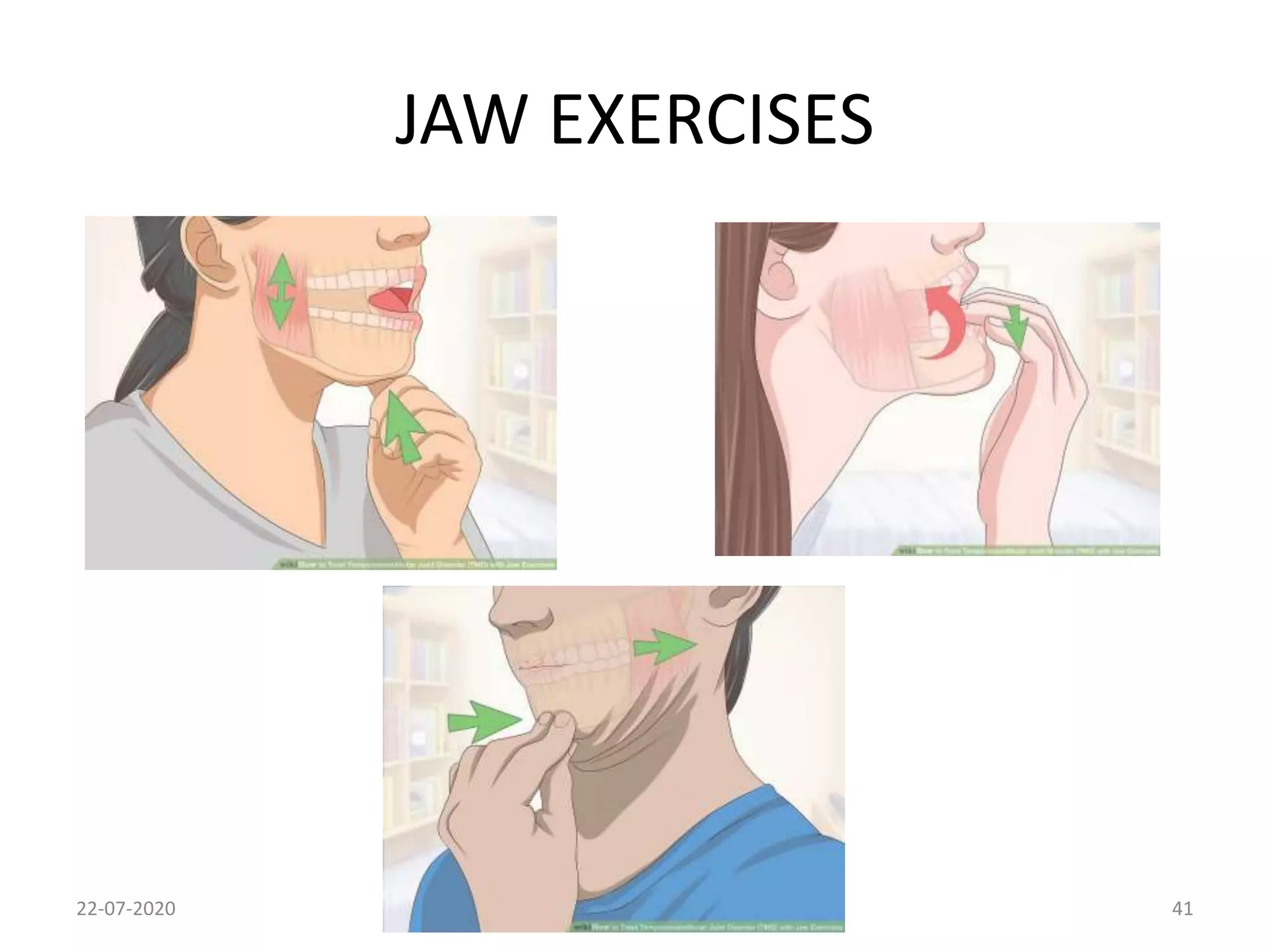 Rehabilitation of Temperomandibular joint dysfunction disorders | PPTX