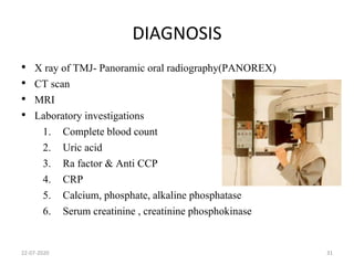 Rehabilitation of Temperomandibular joint dysfunction disorders | PPTX