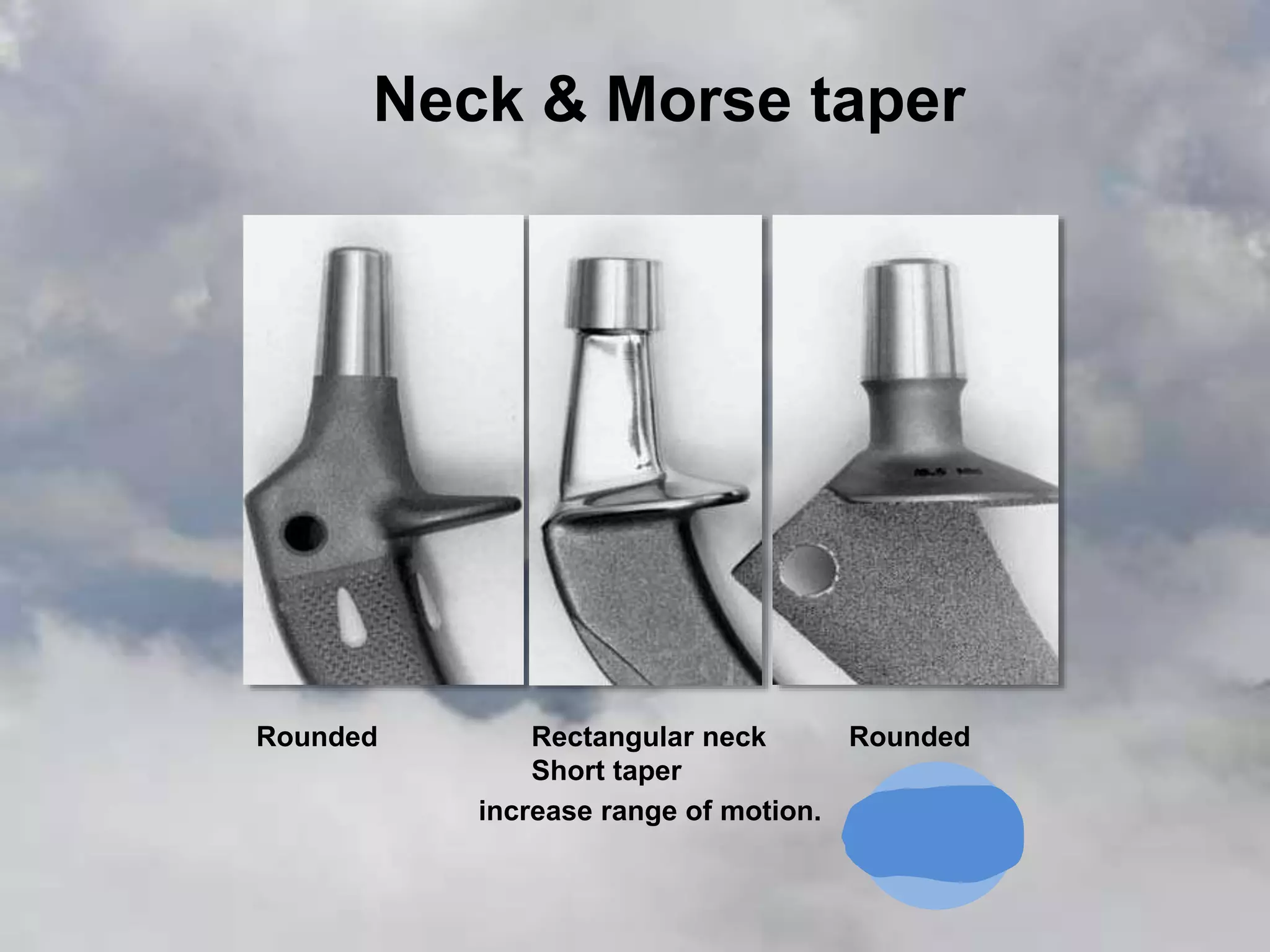 Templating of total hip replacement (THR) | PPTX
