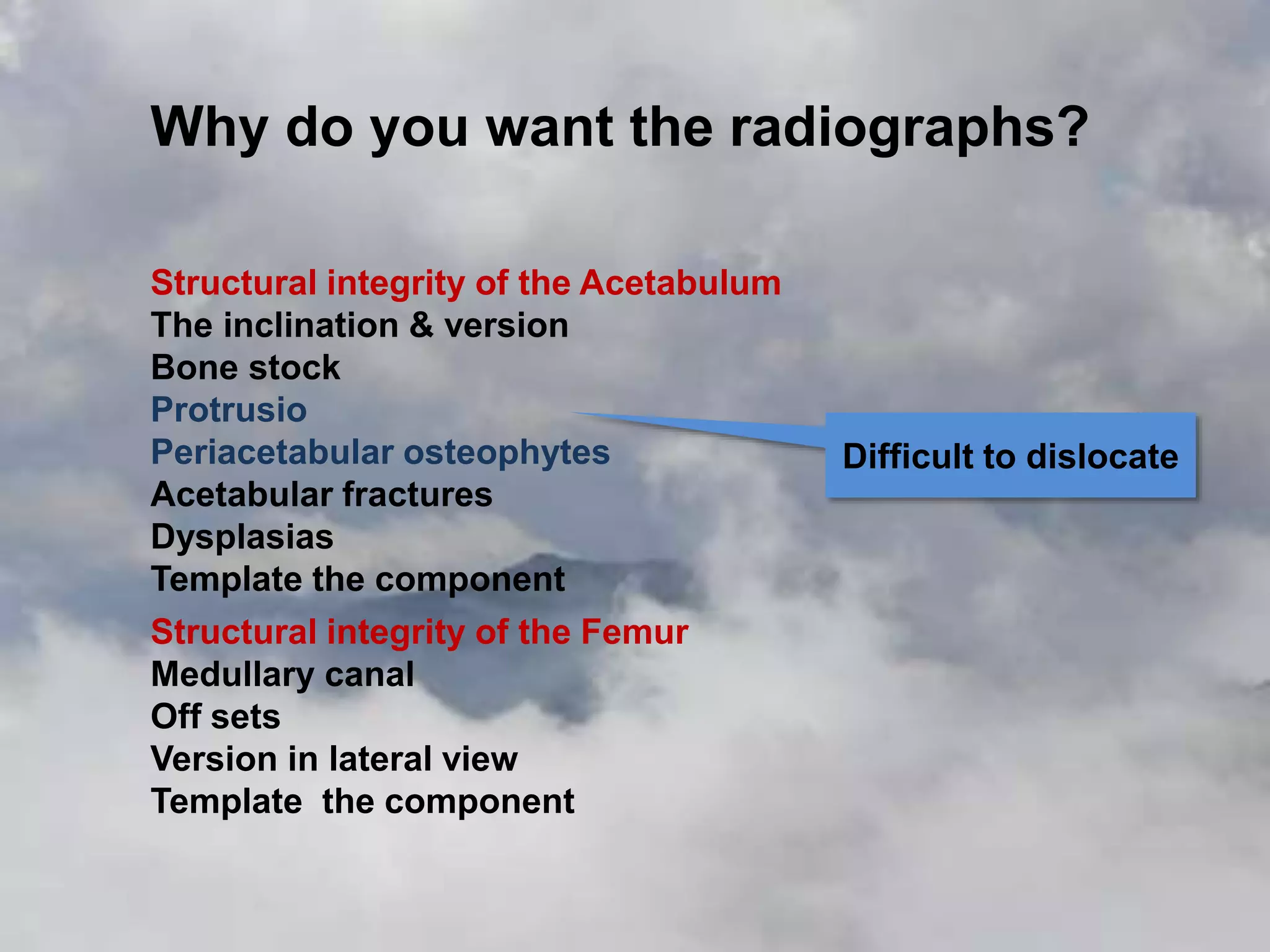 Templating of total hip replacement (THR) | PPTX