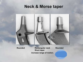 Templating of total hip replacement (THR) | PPTX