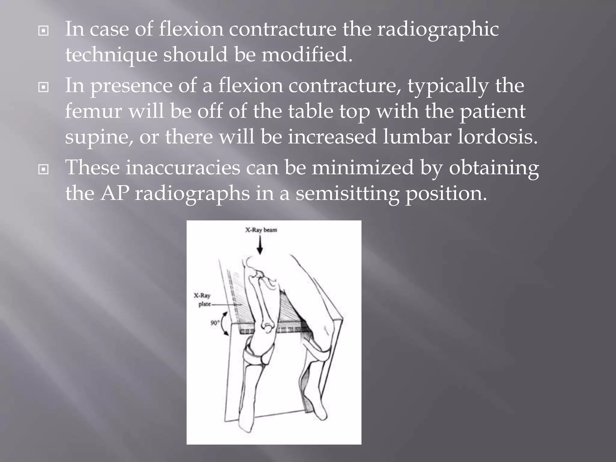 Templating X-rays in THR | PPTX