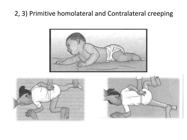 Temple fays and phelps approach in neurophysiotherapy and cerebral ...