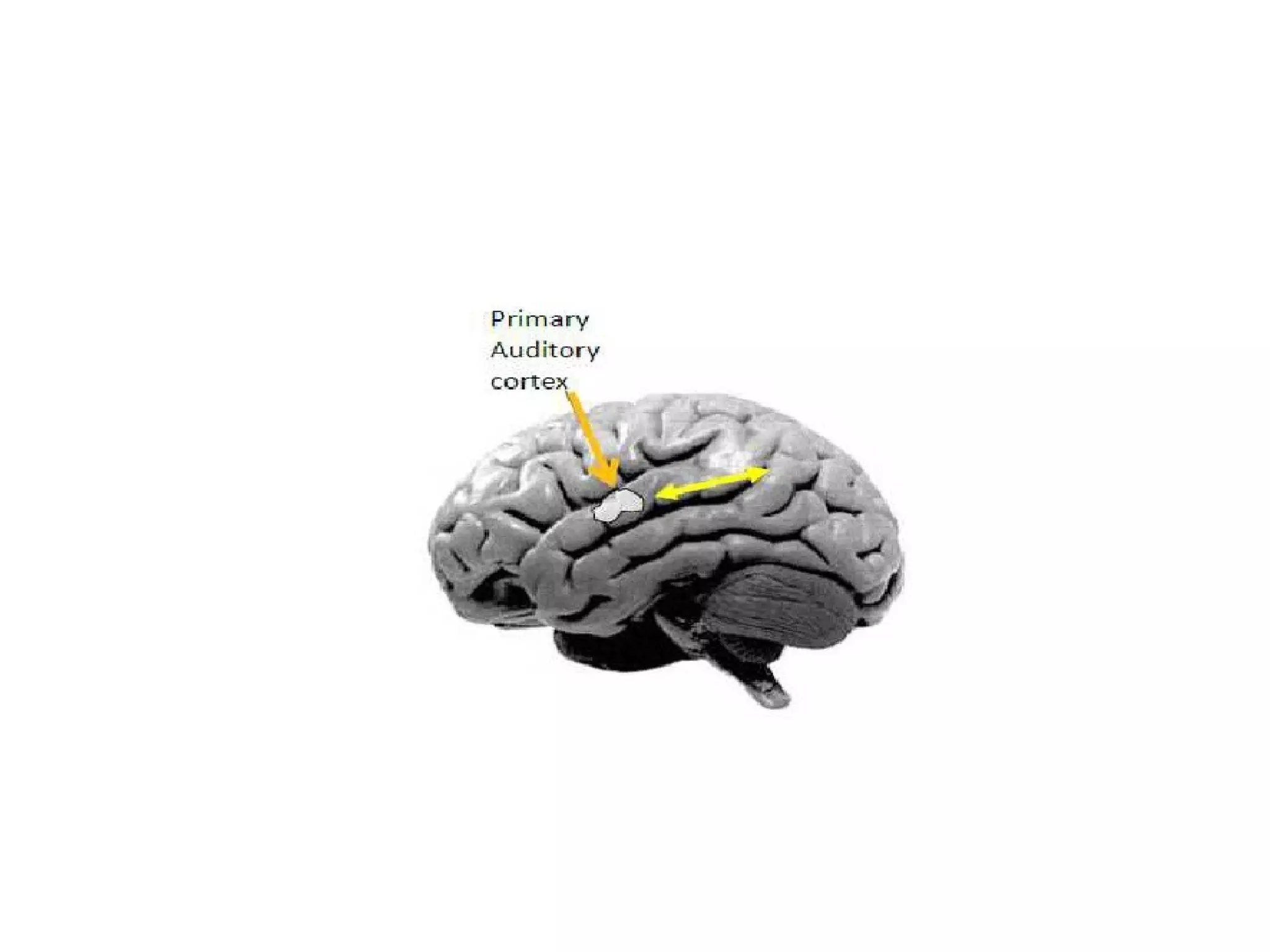 Temporal lobe ppt | PPT