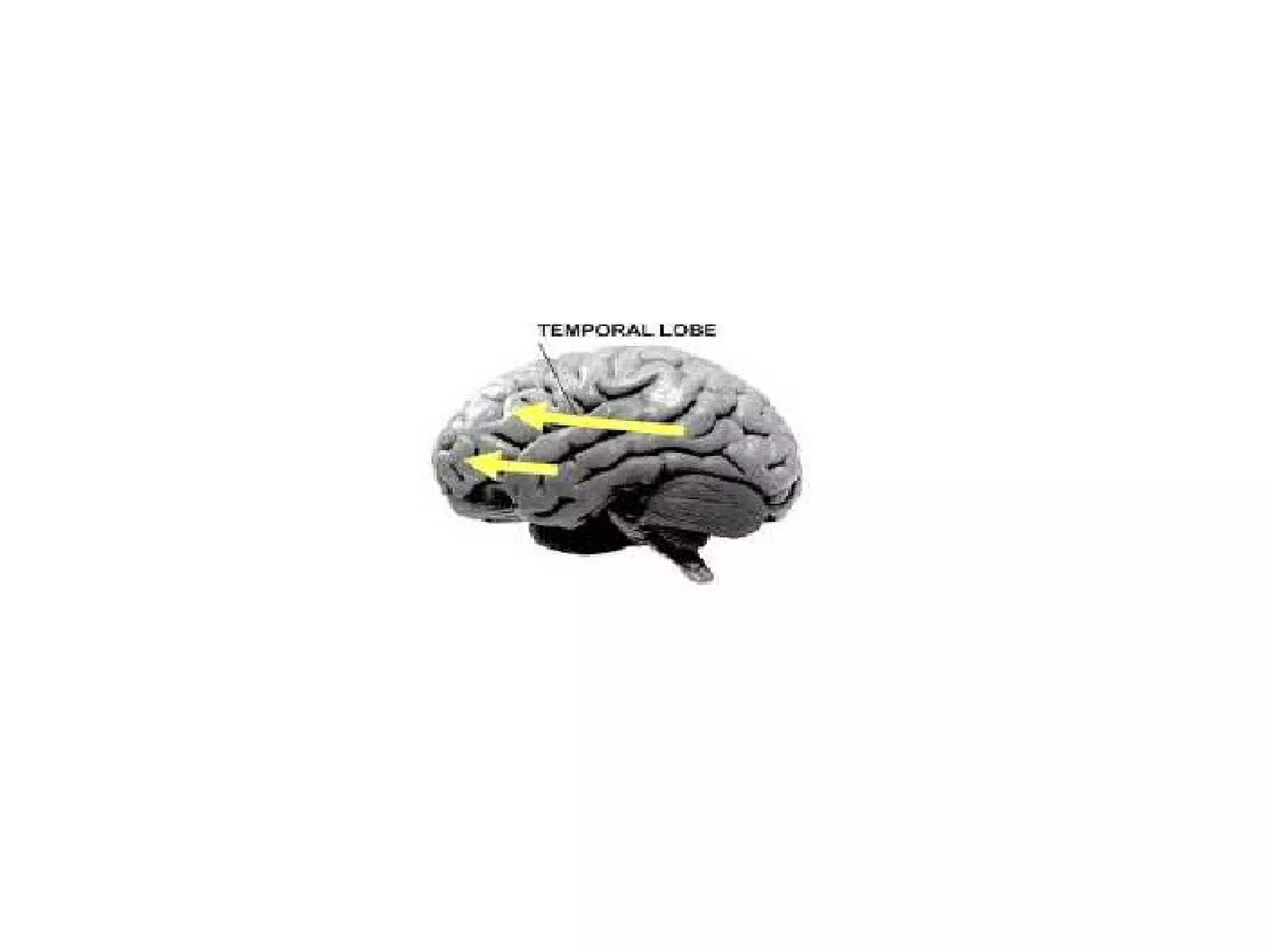 Temporal lobe ppt | PPT