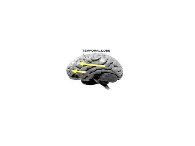 Temporal lobe ppt | PPT | Brain and Nervous System Disorders | Diseases ...