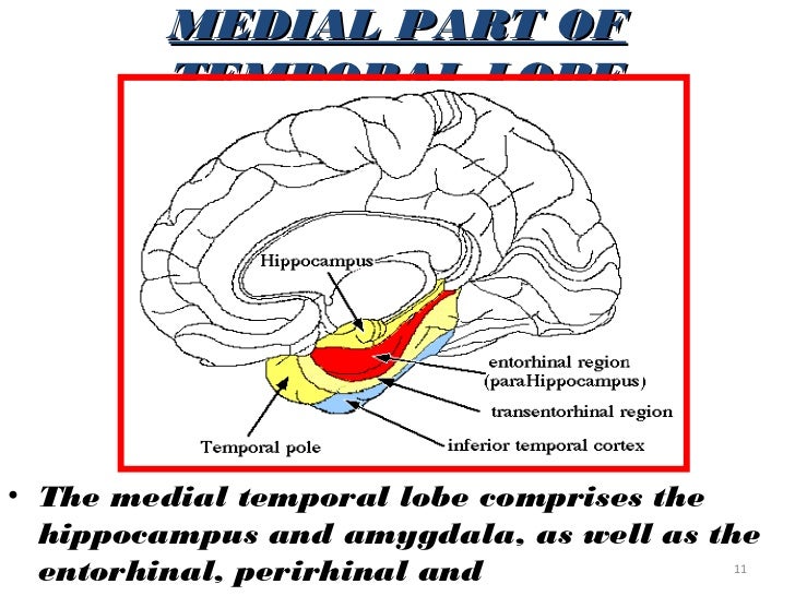 Temporal lobe ppt