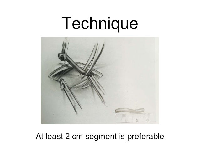 Temporal Artery Biopsy