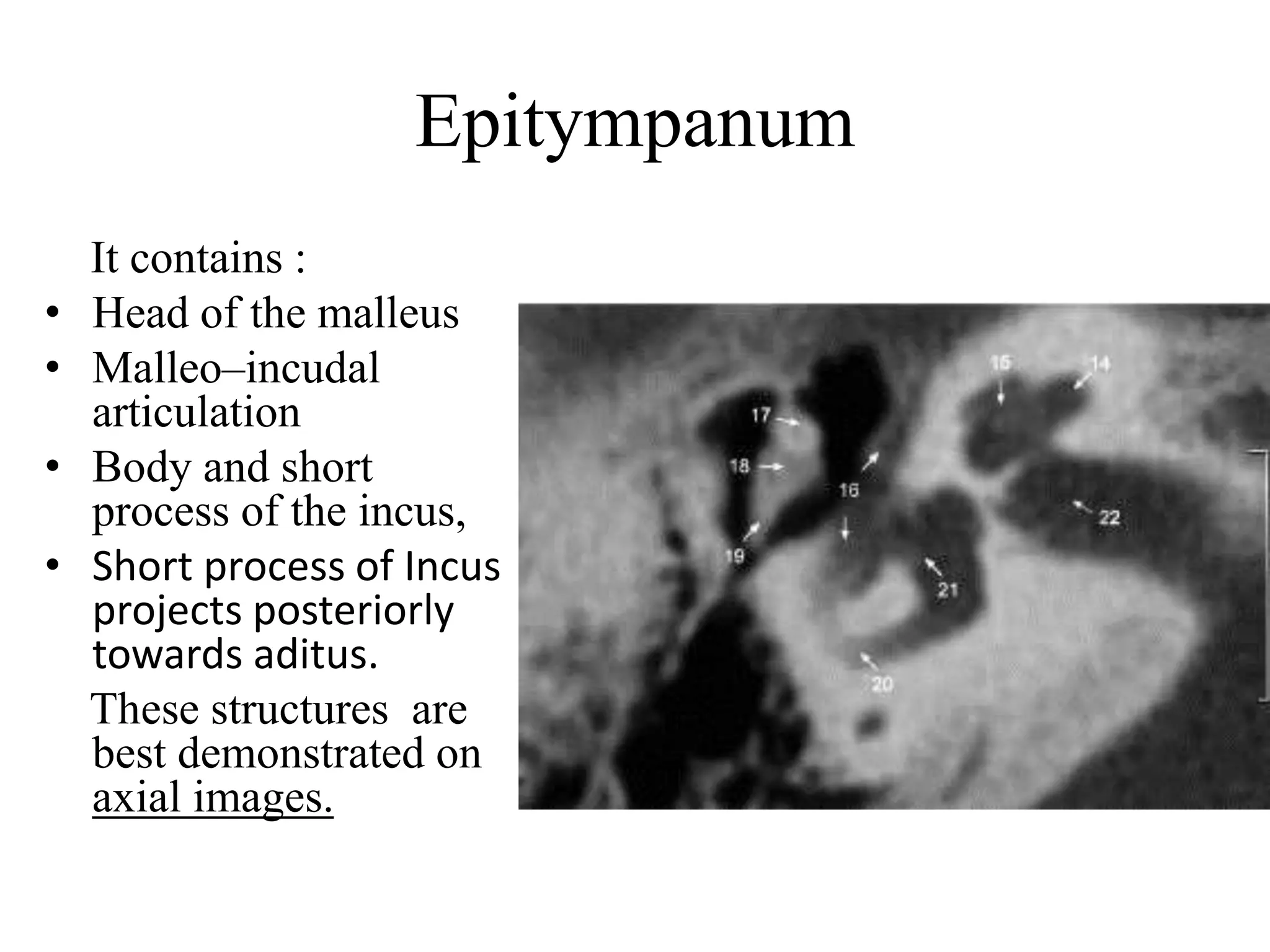 Temporal bone radiology | PPTX