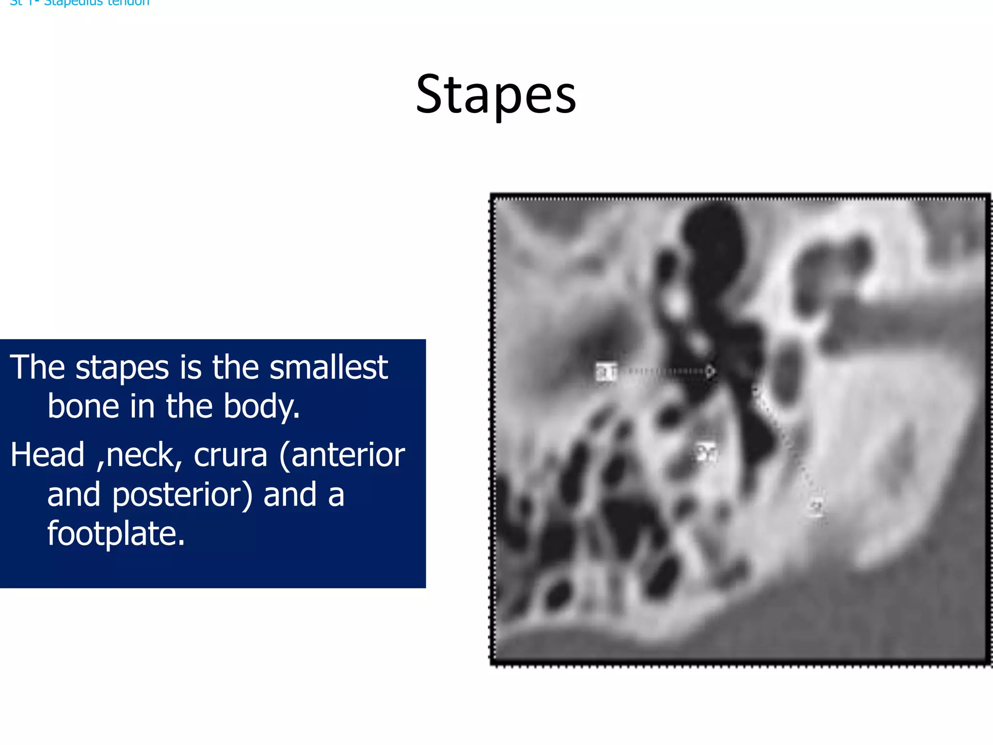 Temporal bone radiology | PPTX