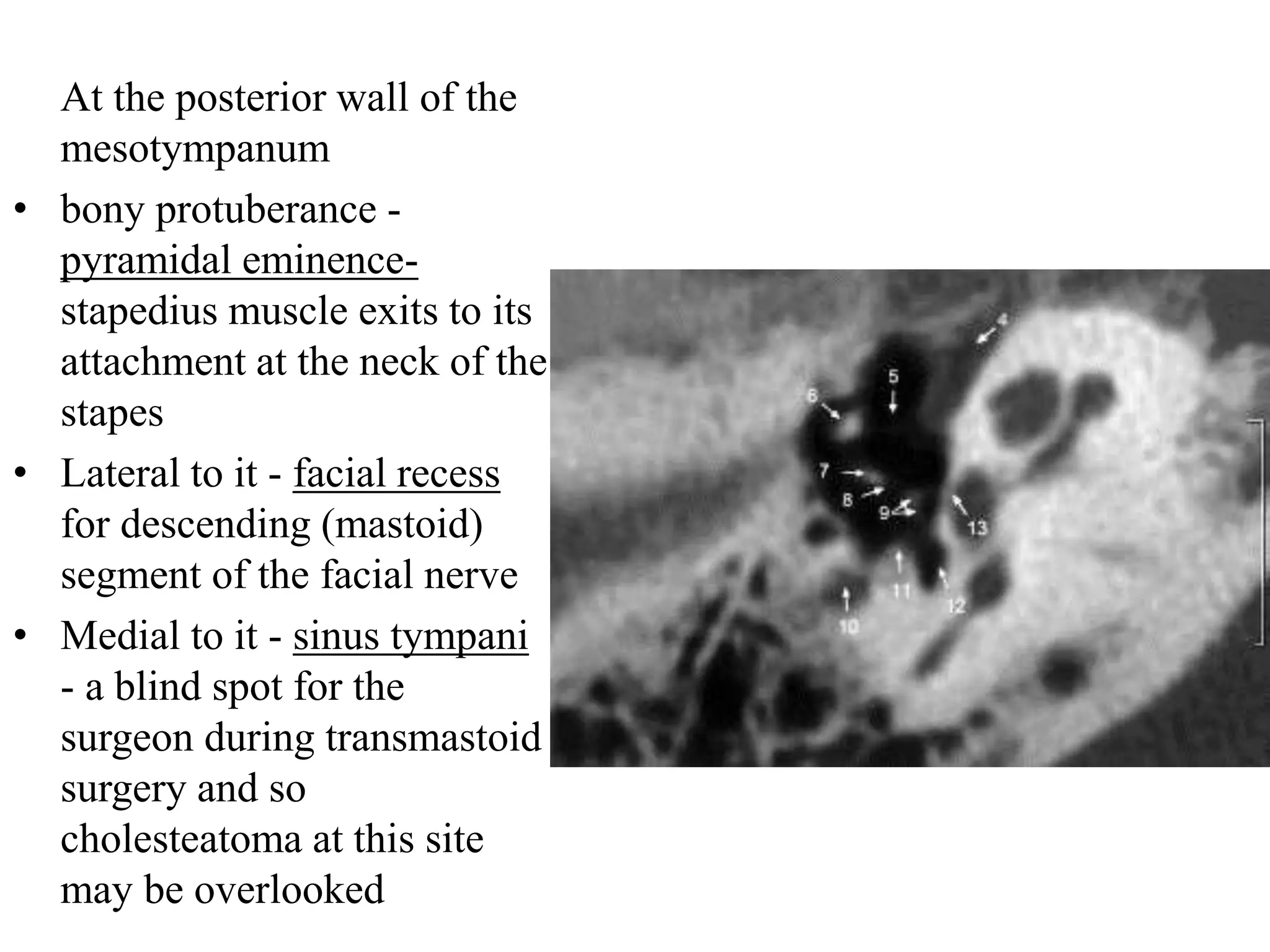 Temporal bone radiology | PPTX