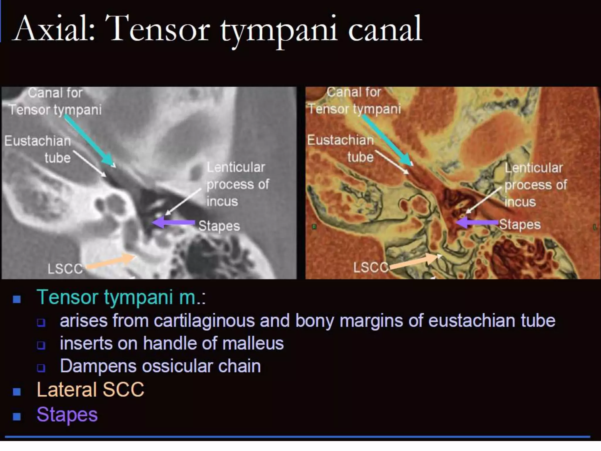 Temporal bone radiology | PPTX