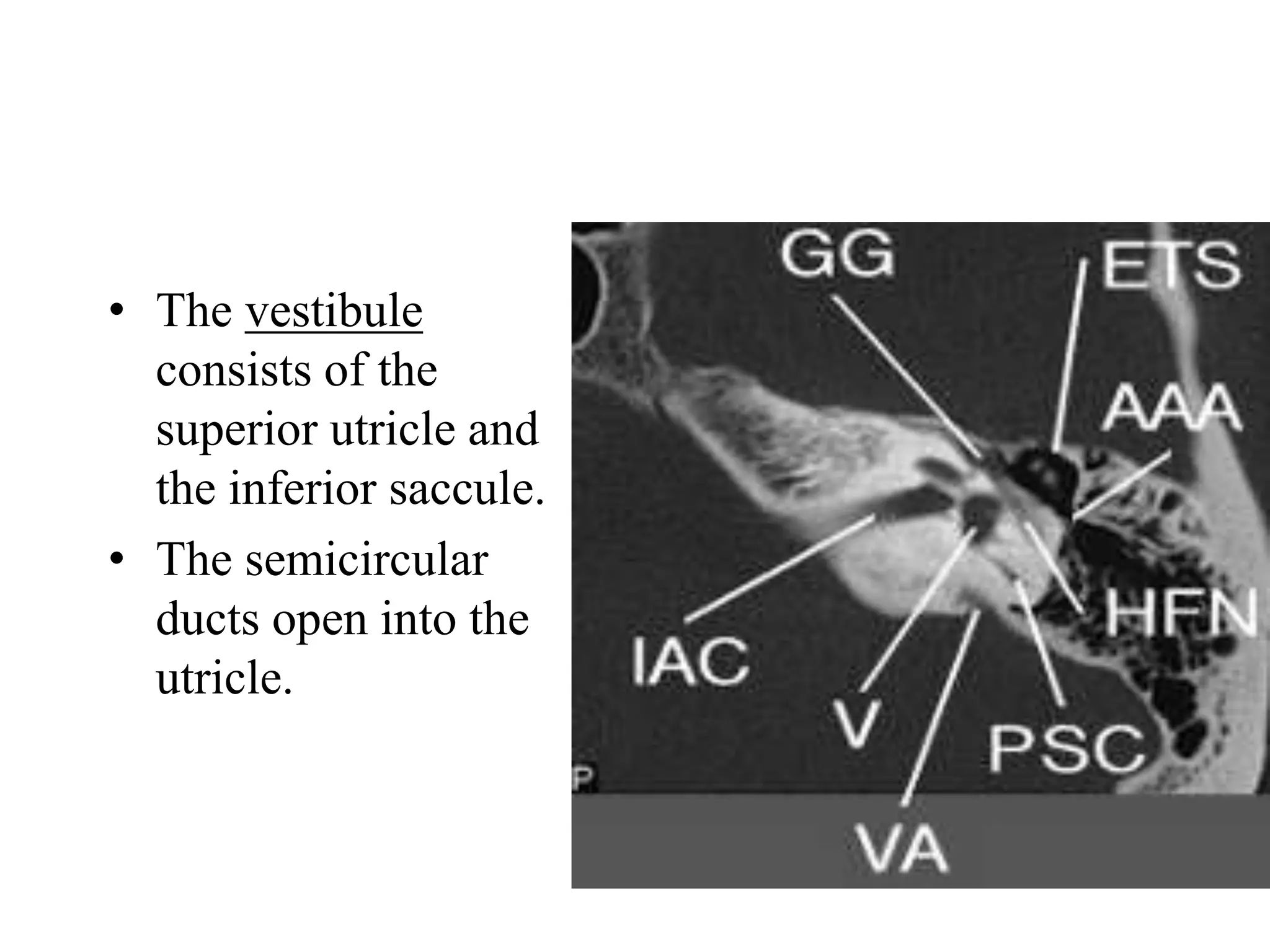 Temporal bone radiology | PPTX
