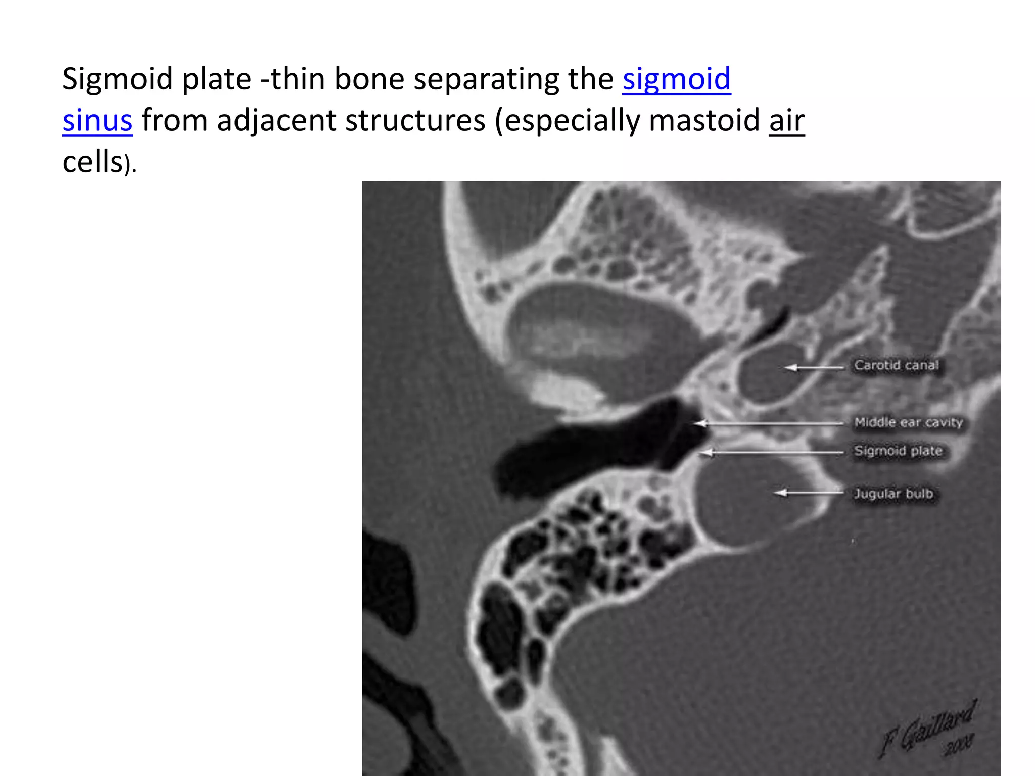Temporal bone radiology | PPTX