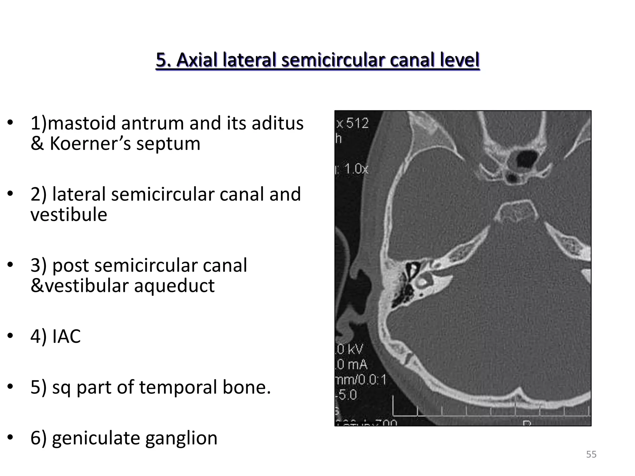 Temporal bone radiology | PPTX