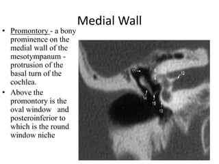 Temporal bone radiology | PPTX