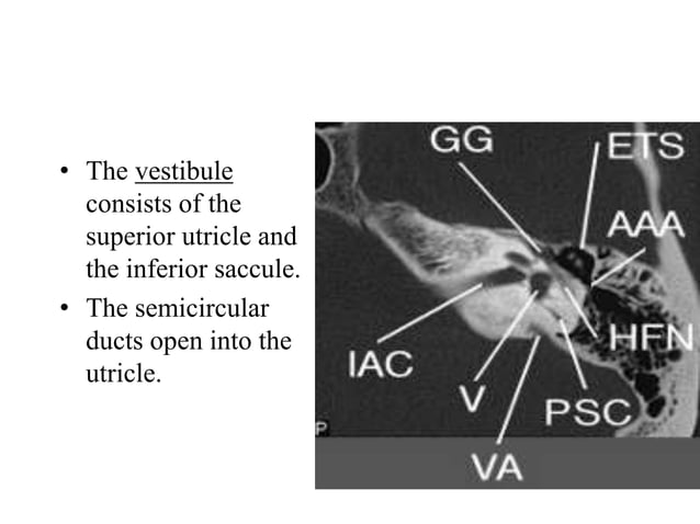 Temporal bone radiology | PPTX | Ear, Nose and Throat Conditions ...