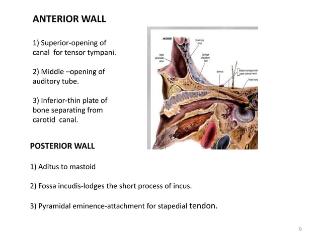 Temporal bone radiology | PPTX | Ear, Nose and Throat Conditions ...