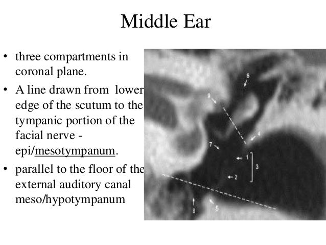 Temporal bone radiology